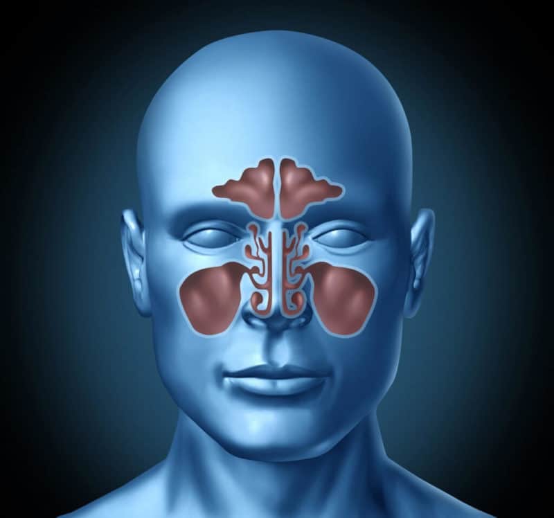Chronic Sinusitis Treatment Near Me, Los Angeles Sinusitis Treatment ...